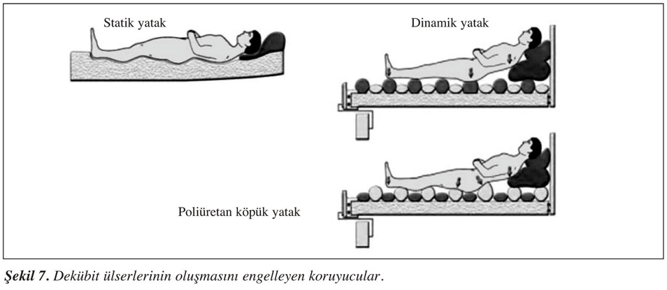 Yoğun Bakımda Dekübit Ülserleri: Risk Faktörleri ve Önlenmesi